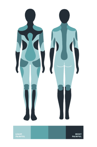 Tattoo Pain Chart: Pain Level of Tattoo by Body Part | Removery